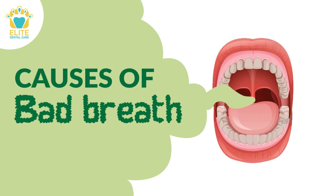 The Top 5 Causes of Bad Breath and How to Address Them